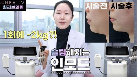1회에 2kg 즉각적인 얼굴지방정리 최강자 힐리브의원 인모드리프팅 리프팅 인모드 Fat 페이스리프트 Youtube