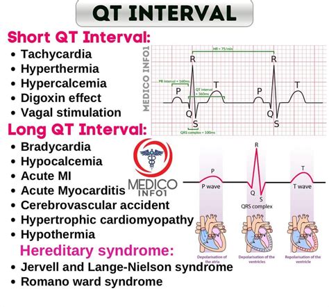 🔰 Qi Interval 🔰 Ecg Ekg Knowledge Of Ecg