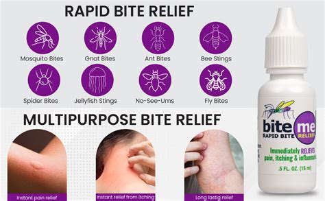 Bite Me Insect Bite Relief Bug Bite Itch Relief Gel