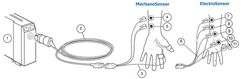 Nmt Helping To Optimize Recovery From Anesthesia Clinical View