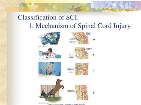 Spinal Cord Injury Levels Classification Frontiers Extensive