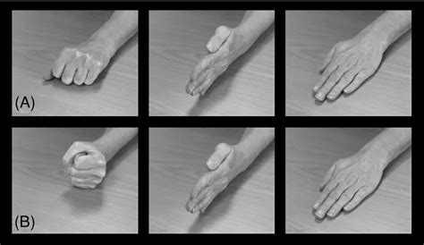 Test De Luria Nebraska Una Herramienta Para Evaluar La Función Neuropsicológica Motorba