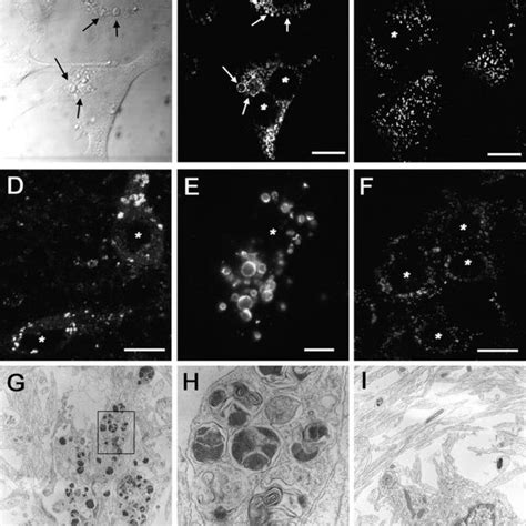 Enlarged Lysosomal Organelles Are Visible In Ps1 − − Cells A