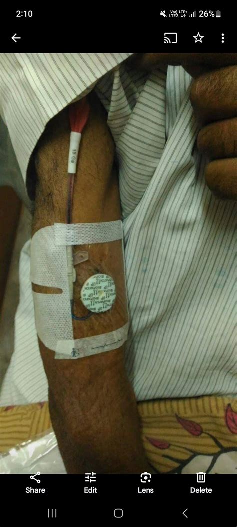 Picc Line Insertion With Applications Of Tegaderm Picc Line Reduces Superficial Thrombophlebitis