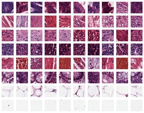 Github Io Commits Histopathology Classification