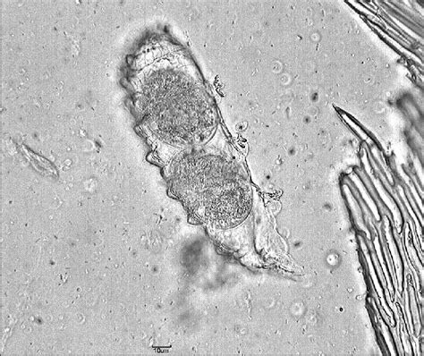 Many Tardigrades Store Their Eggs Underneath The Cuticle Afterwards Download Scientific