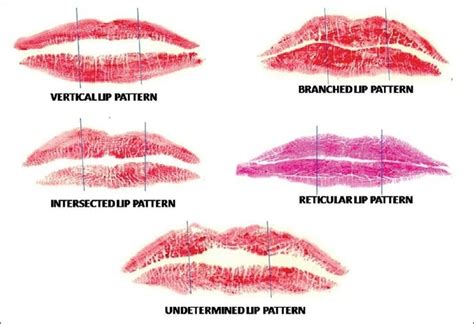 Forensic Perspectives International Forensic Consulting Lip Patterns