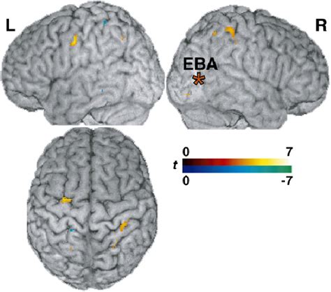 Results Of The Functional Connectivity Analysis Statistical Group