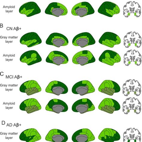 Multiplex Brain Modules For Each Group We Found 2 Modules In The Cn