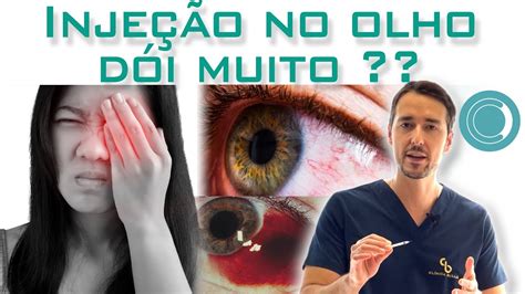 Injeção Intravítrea De Antiangiogênico Dói Muito Youtube