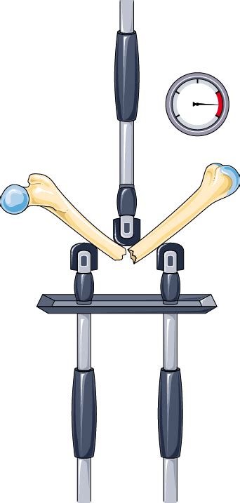 Femur Compression Test Servier Medical Art
