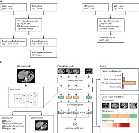 Echinococcosis Ct Cmdt Media Library Accessmedicine Mcgraw Hill Medical