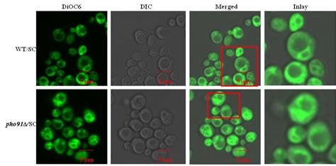 Membrane Staining By Dioc6 The Wt And Pho91∆ Cells Were Grown In Sc