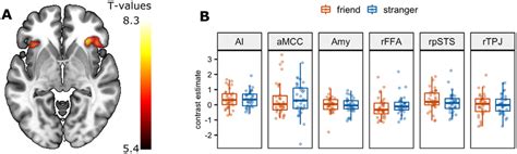 Activation In The Direct Expression Stage Cs Cs Contrast Note
