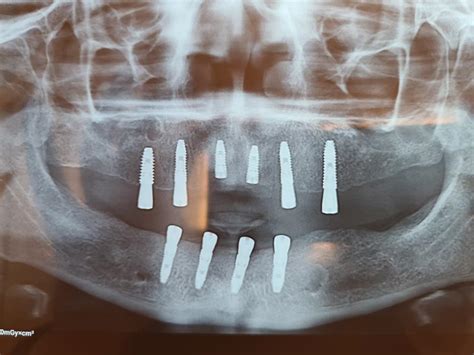 گالری دکتر حمید پاچناری متخصص جراحی فک و صورت