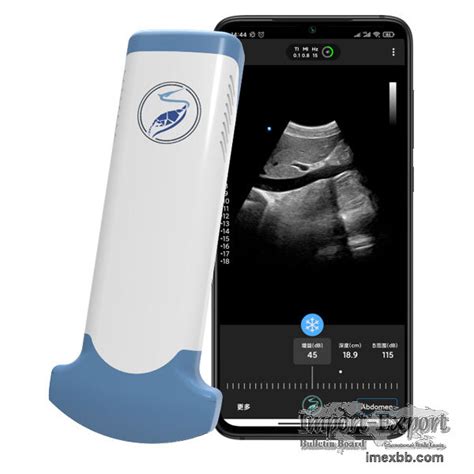 Common Types Of Ultrasonic Probes
