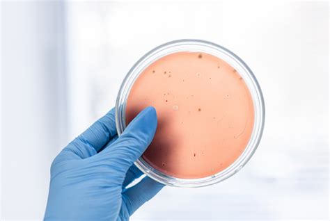 실험실의 미생물학실에서 한천 배지에서 페트리 접시 박테리아 배양 성장을 들고 있는 장갑 낀 손 검은 배경에 과학자의 손에 있는 페트리 접시에 있는 노란색 박테리아 0명에