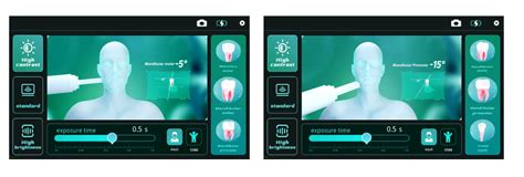 Dynamic Portable X Ray Dx Unit China Dynamic Portable X Ray Dx Unit