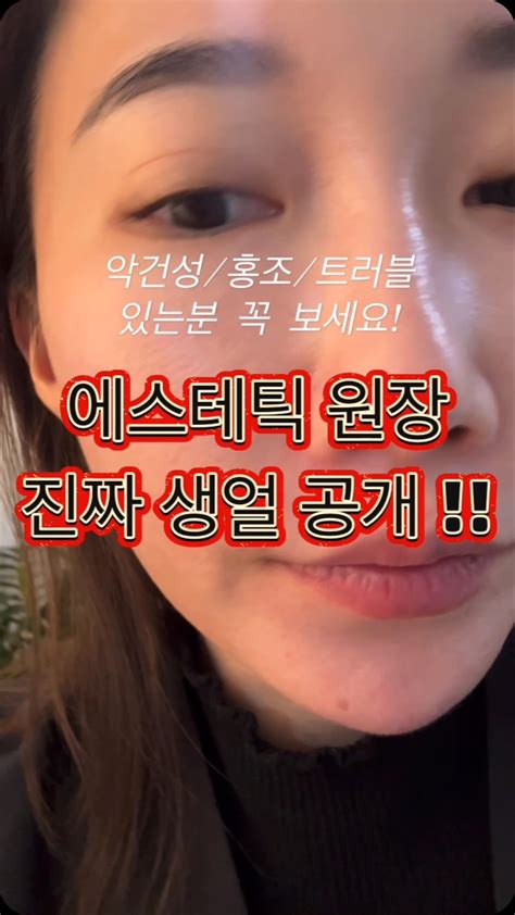 실장을 교육하는 총괄실장이 관리하는 셀디브에스테틱 차원이 다른 섬세한 아름다운 가치 셀디브🌿 더뉴바디 등옆구리케어”🔥