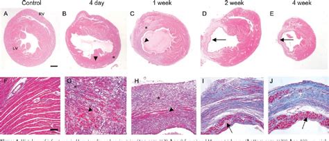 Figure 1 From Myofibroblast And Endothelial Cell Proliferation During Murine Myocardial Infarct