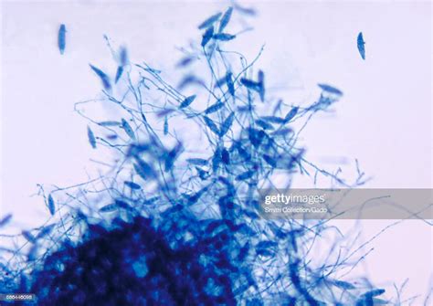 This Is A Photomicrograph Of The Fungus Microsporum Gypseum Using The This Is A Photomicrograph Of The Fungus Microsporum Gypseum Using The