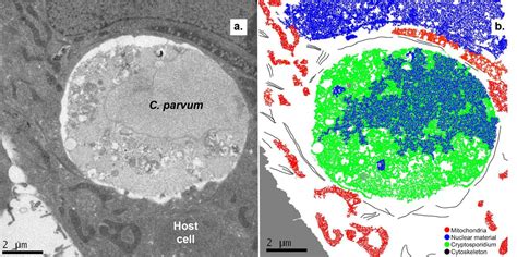 Cryptosporidium Parvum Microscope