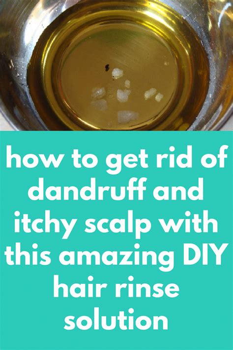 How To Remove Dandruff From Scalp How To Overcome And Remove Dandruff
