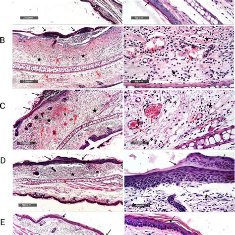 Histopathological Photomicrographs Of Hande Stained Infected Ear Sections