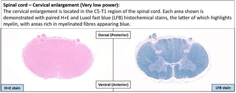 Spinal Cord Histology Identification Points