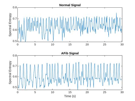 Classify Ecg Signals Using Long Short Term Memory Networks Matlab And Simulink