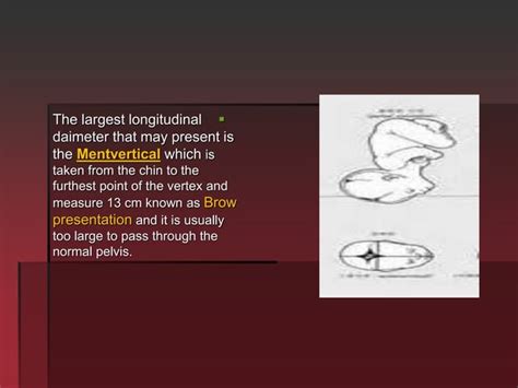 Plevic And Fetal Skull Persented By Nursing Student For Classes