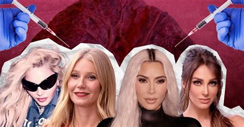 De Comer Placenta A Inyectarse Su Propia Sangre Los Tratamientos Más