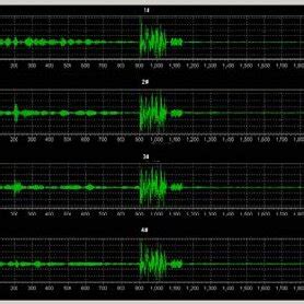 Waveforms Of Combined Target Signals With Reverberation From Target Download Scientific Diagram