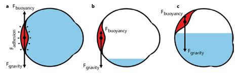 Figure 3 From Subretinal Hemorrhage Semantic Scholar