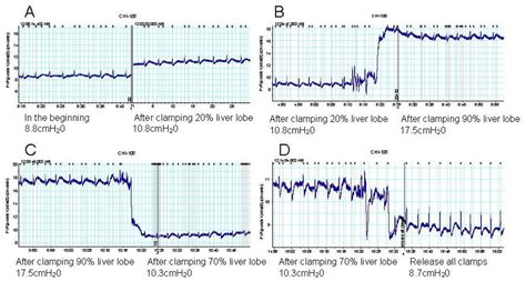 Monitoring Of Systemic And Hepatic Hemodynamic Parameters In Mice