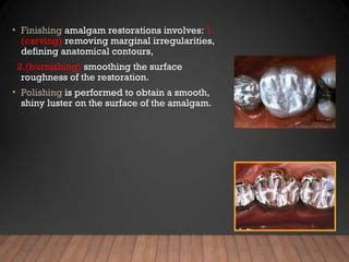 Amalgam Filling Material In Conservative Dentistry Ppt