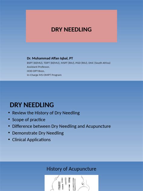 Lecture No 04 Dry Needling Pdf Arm Elbow