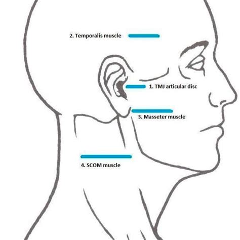 Reference Points For Sonographic Explorations Download Scientific Diagram