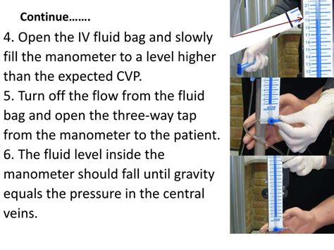 Ppt Central Venous Line Cvl And Central Venous Pressure Cvp