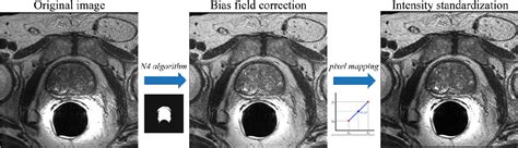 Figure 2 From Integration Of Deep Learning And Active Shape Models For More Accurate Prostate
