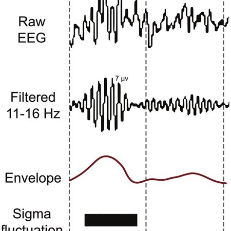 Spindle Detection Method And Definition Of Spindle Parameters The Eeg