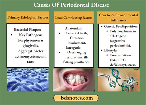 Causes Of Periodontal Disease Bds Notes