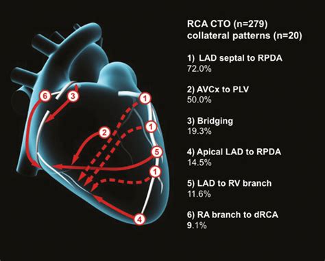 The Collateral Circulation Of Coronary Chronic Total Occlusions
