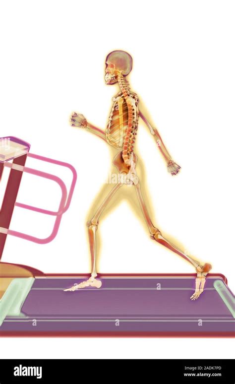 Fitness Training Enhanced X Ray Of A Person Running On A Treadmill