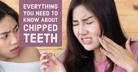 Everything You Need To Know About Chipped Teeth