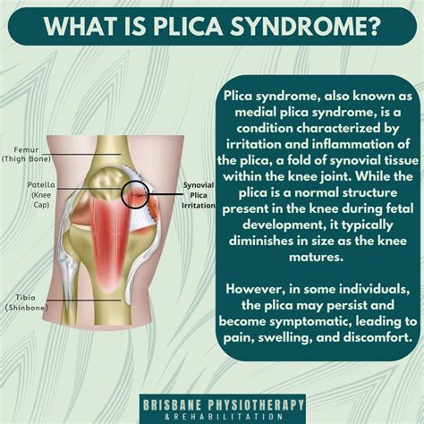 Plica Knee Anatomy