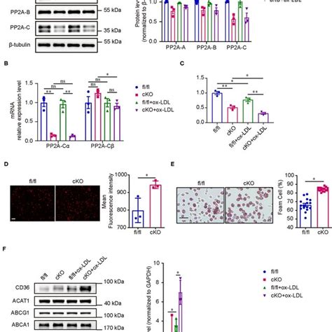 Pp2a Deficiency In Macrophages Promoted Foam Cell Formation A Left Download Scientific