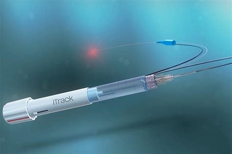 Itrack Ophthalmic Singapore