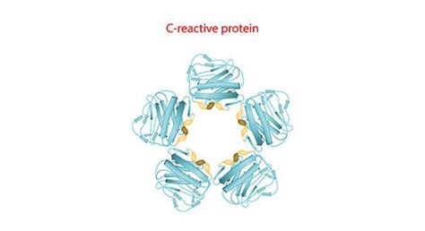 C Reactive Protein And Its Surprising Role In Rheumatoid Arthritis Modern Com