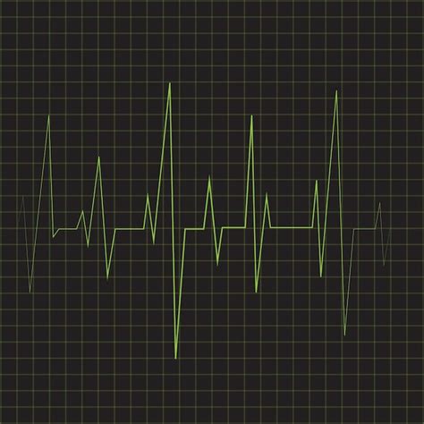 Premium Vector Vector Cardiogram